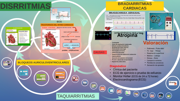 DISRRITMIAS by José Eduardo Tejerina on Prezi