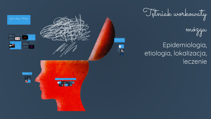 Tętniak workowaty mózgu by Jan Jabłonowski-Kęska on Prezi