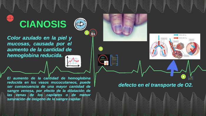 CIANOSIS by mayerlin perez on Prezi
