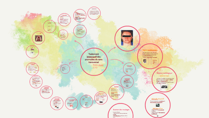 Traitement interceptif des anomalies du sens transversal by Raies Arwa ...