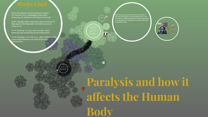 Paralysis and how it affects the Human Body by Anslee Cuthbert on Prezi