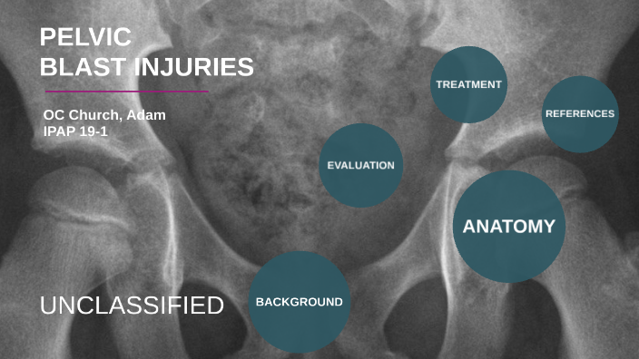 Pelvic Fracture Care by Adam Church on Prezi