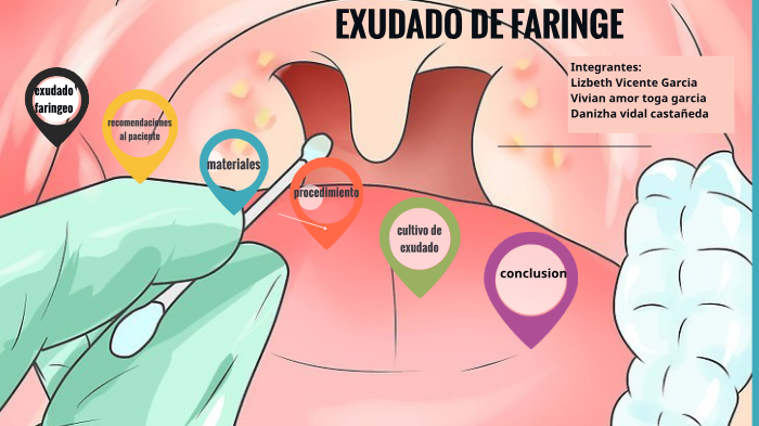 EXUDADO DE FARINGE by lizbeth vicente garcia on Prezi