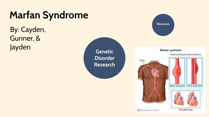 Marfan Syndrome by Cayden Spuhler on Prezi
