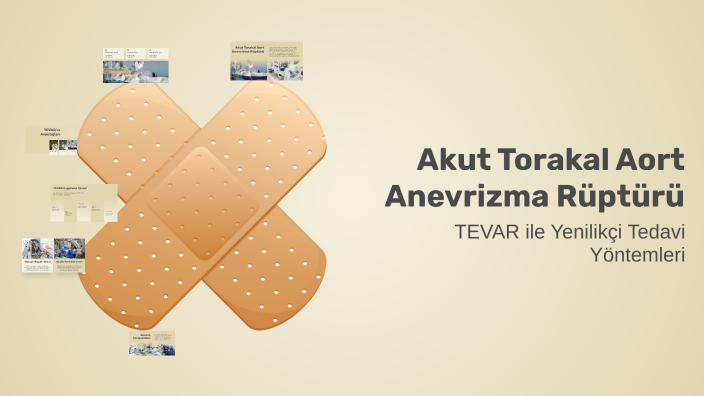 Akut Torakal Aort Anevrizmaları by Berat Kekeç on Prezi