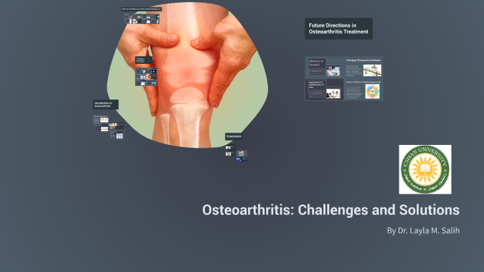 Osteoarthritis: Challenges and Solutions by layla salih on Prezi