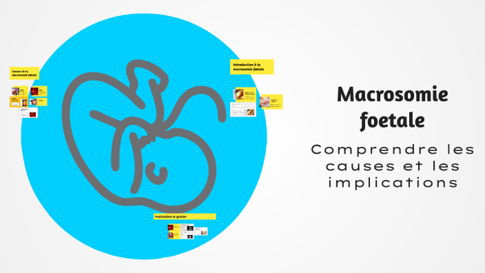 Macrosomie foetale by Djarir Sabrine on Prezi