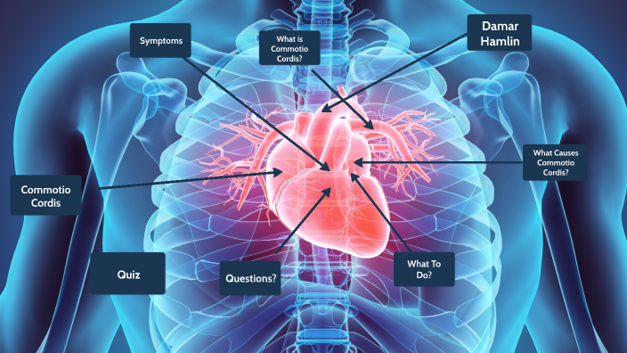 Commotio Cordis by Aidan Lawrence on Prezi