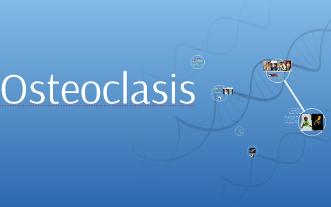 Osteoclasis by bri wilson on Prezi