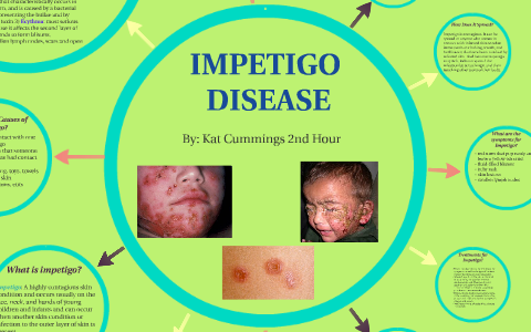IMPETIGO PRESENTATION by Kat Cummings on Prezi