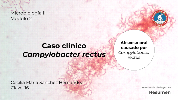 Caso clínico - Campylobacter rectus by CECILIA MARIA SANCHEZ HERNANDEZ ...