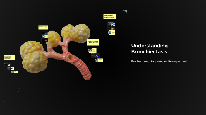 Understanding Bronchiectasis by Hala Sule on Prezi