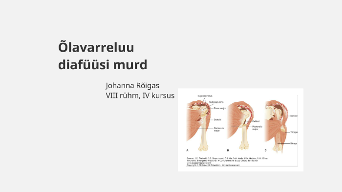 Õlavarreluu diafüüsi murd by Johanna Rõigas on Prezi