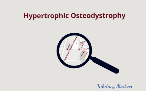 Anatomy & Physiology - Bone Condition - Hypertrophic Osteodystrophy by ...