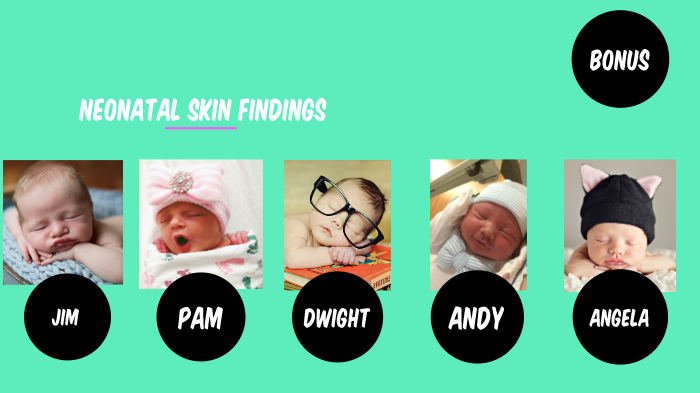 Neonatal Skin Findings by Blake Hatfield on Prezi