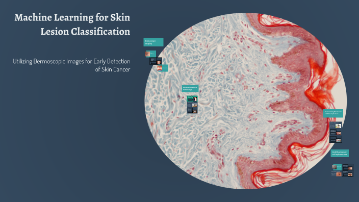 Machine Learning For Skin Lesion Classification By Shreyansh Gupta On Prezi