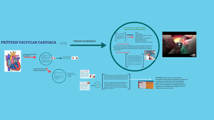 PROTESIS VALVULAR CARDIACA by olga gabiola on Prezi