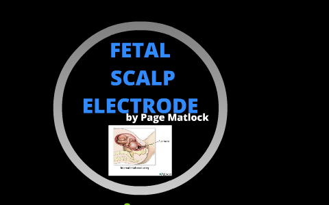 Fetal Scalp Electrode by Page Prokop on Prezi