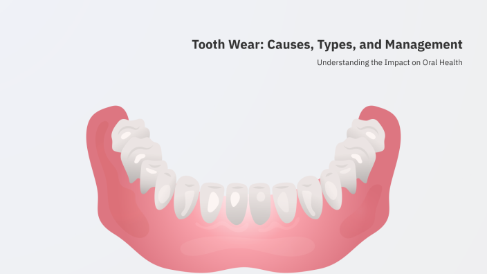 Tooth Wear: Causes, Types, and Management by ibrahim elahl on Prezi