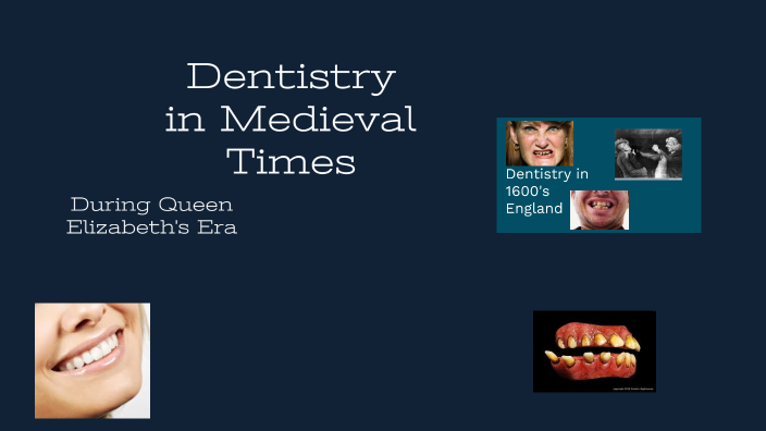 Dentistry in Medieval Times by Fabian Delagarza on Prezi