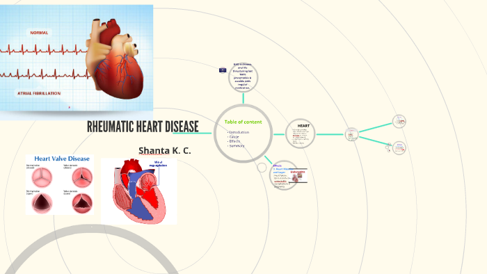 RHEUMATIC HEART DISEASE by Shanta Kc on Prezi