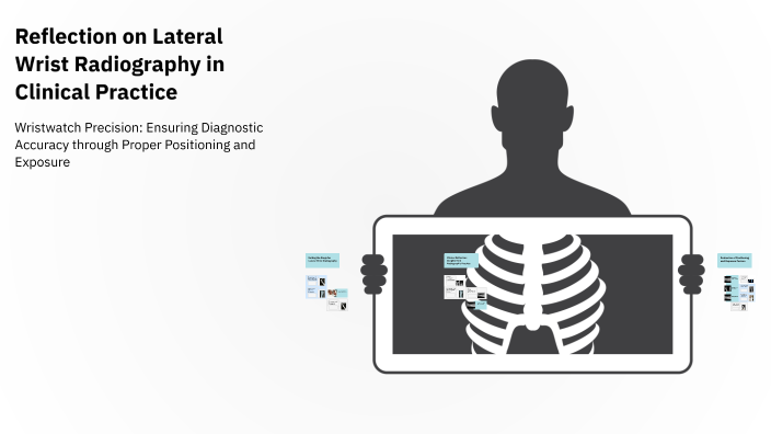 Reflection on Lateral Wrist Radiography in Clinical Practice by irencheto arn on Prezi