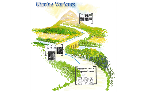 Uterine Variants by Neal Larkman on Prezi