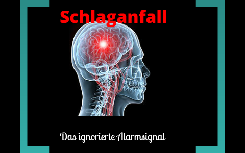 Schlaganfall by Sara Barszczowska on Prezi