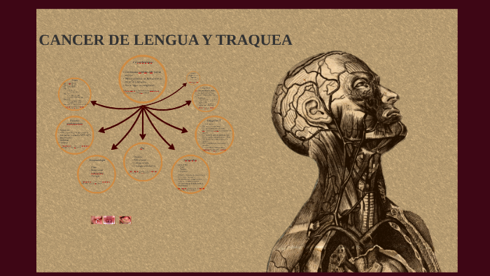 CANCER DE LENGUA Y TRAQUEA by Fabrizzio Argueta on Prezi