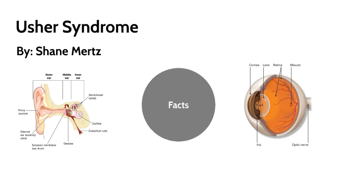 Usher Syndrome-Shane Mertz by Shane Mertz on Prezi