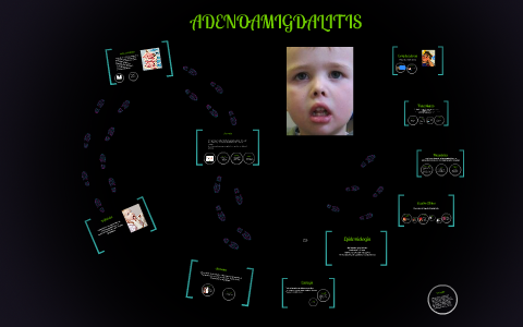 ADENOAMIGDALITIS by Nishi Martz on Prezi