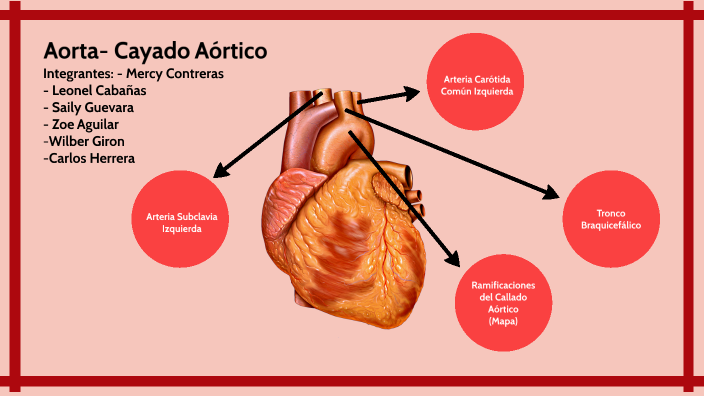 Presentación Cayado Aórtico by Saily Guevara Raudales on Prezi