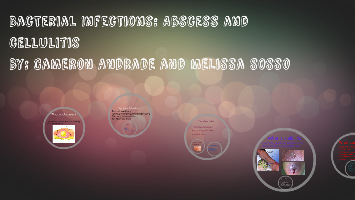 Bacterial Infection: Abscess and Cellulitis by Cameron Andrade on Prezi