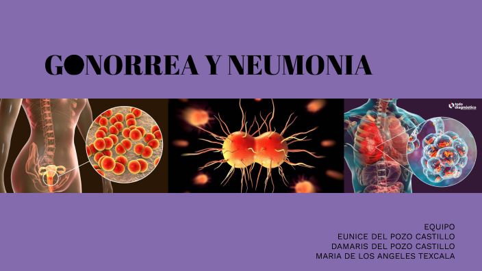 NEUMONIA Y GONORREA by damaris on Prezi
