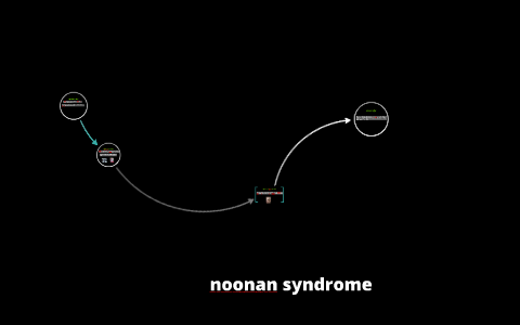 noonan syndrome by Brandon Adkins on Prezi