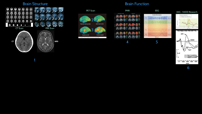 Unit 7: Brain Imaging Analysis by Joseph Giorlando on Prezi
