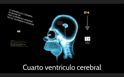 Cuarto ventrículo cerebral by Tony Rock on Prezi