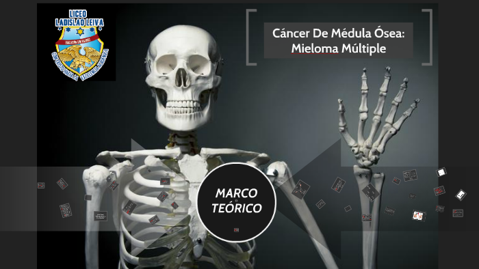 Cancer De Medula Osea by Jocelyn Espinoza on Prezi
