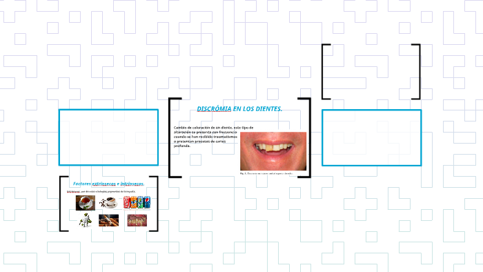 CAUSAS DE DISCRÓMIA EN DIENTES. by Jose Caraveo Alor on Prezi