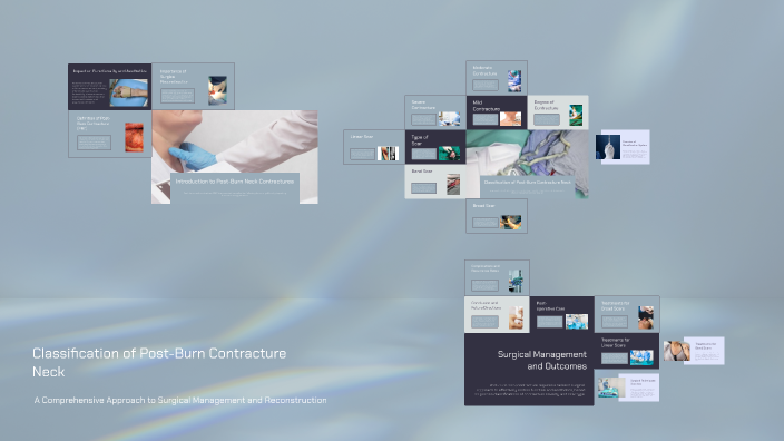 Classification of Post-Burn Contracture Neck by Foaida Omar on Prezi
