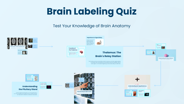 Brain Labeling Quiz by alayna khan on Prezi