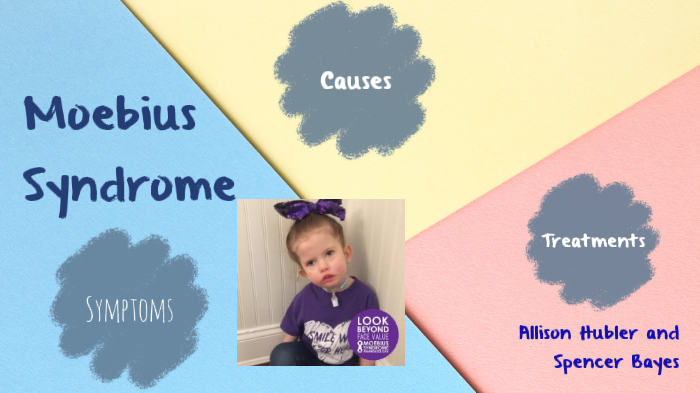Moebius syndrome by Allison Hubler on Prezi
