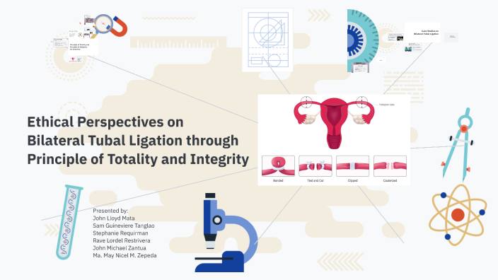 G4 - Bilateral Tubal Ligation by Ma. May Nicel Zepeda on Prezi