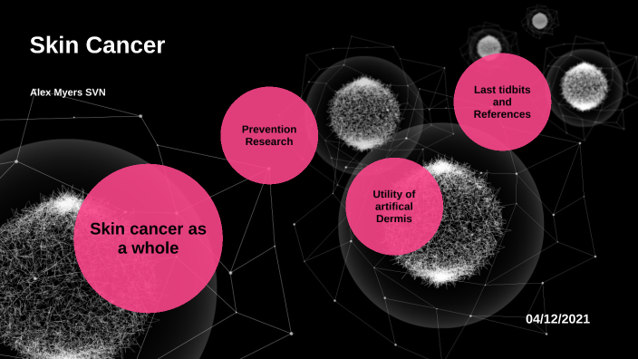 Skin Cancer Presentation by Alex Myers on Prezi