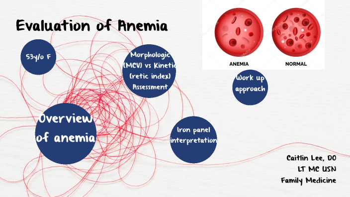 Evaluation of Anemia by Caitlin Lee on Prezi
