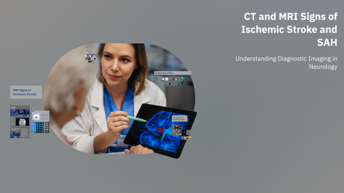 CT and MRI Signs of Ischemic Stroke and SAH by Iman Abdulqader on Prezi