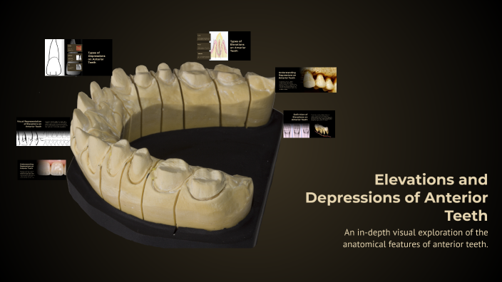 Elevations and Depressions of Anterior Teeth by Malak Essam on Prezi