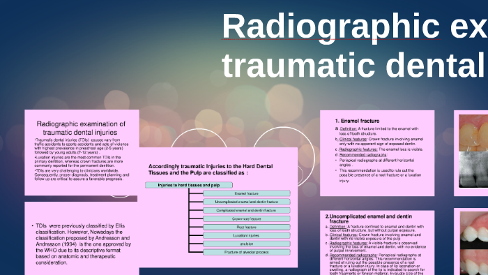 Radiographic examination of traumatic dental injuries by sohaila yehya ...