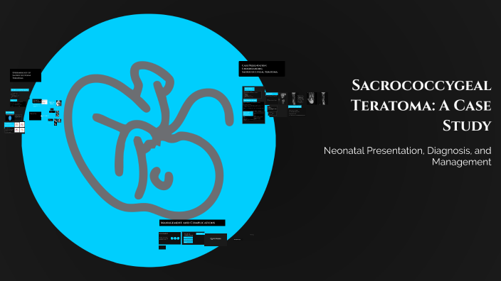 Sacrococcygeal Teratoma: A Case Study by manar nader on Prezi