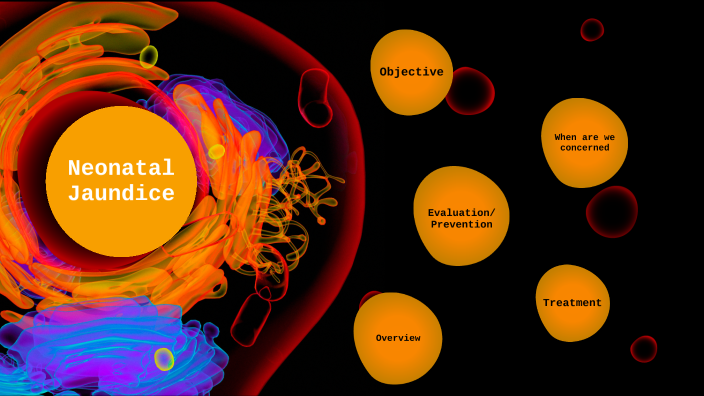 Neonatal Jaundice by Tayina Gilles on Prezi